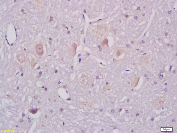 ganglioside GM1抗体 (GTX50971) | GeneTex中国官方网站