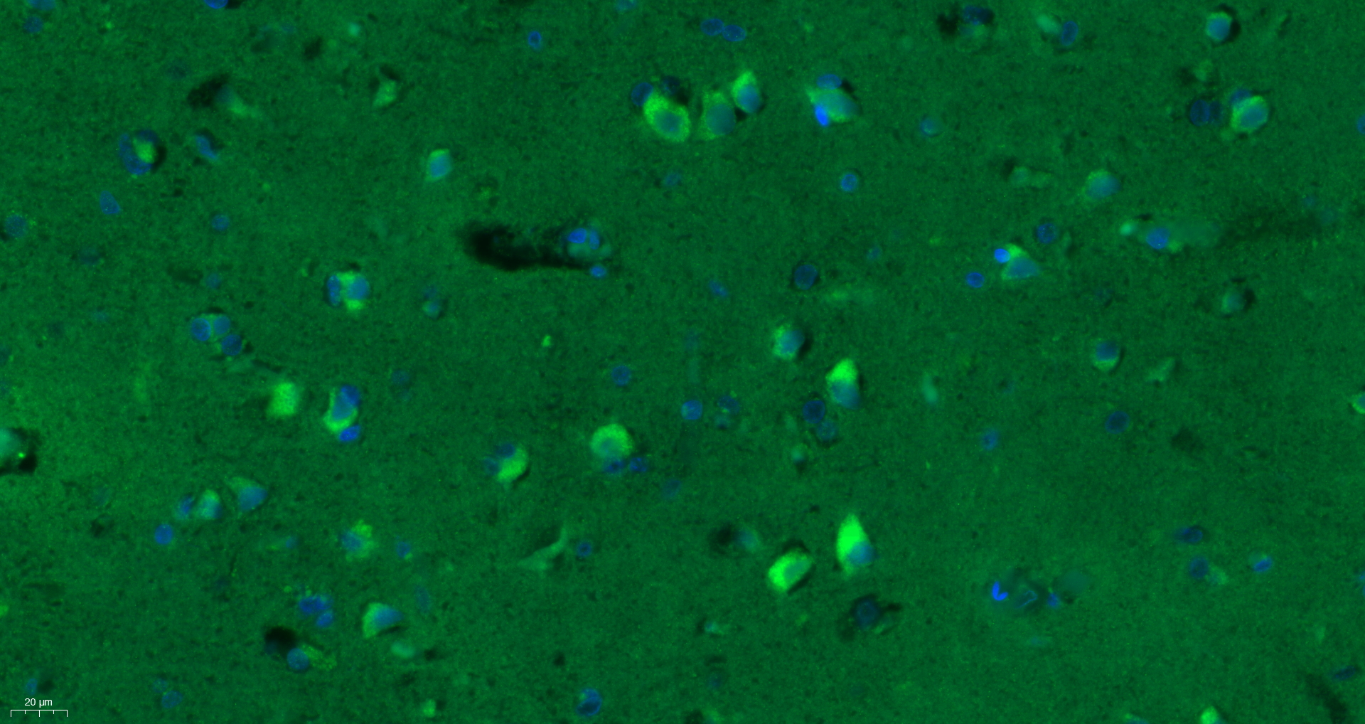 GABA A Receptor gamma 2抗体 (GTX51587) | GeneTex中国官方网站