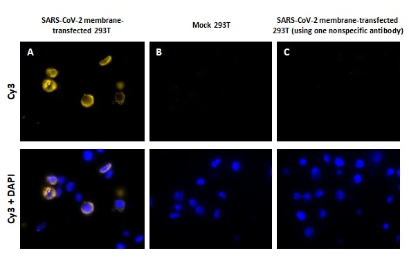 SARS-CoV-2 Membrane Protein Proximity Ligation Assay (PLA) Kit (Cy3 ...