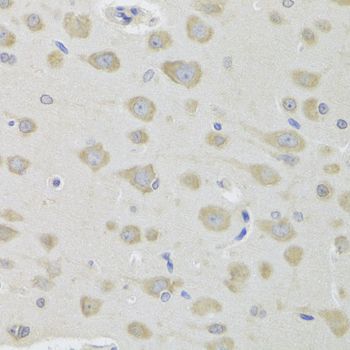 DHRS9抗体 (GTX54001) | GeneTex中国官方网站