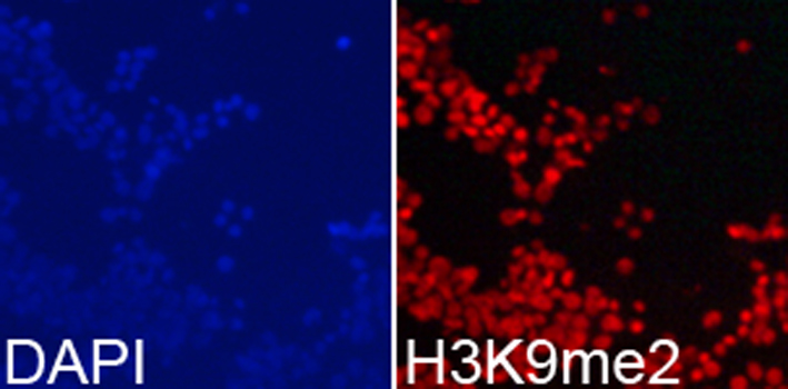Histone H3K9me2 (di-methyl Lys9)抗体 (GTX54102) | GeneTex中国官方网站