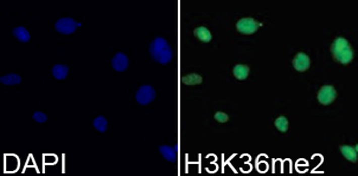 Histone H3K36me2 (di-methyl Lys36)抗体 (GTX54108) | GeneTex中国官方网站