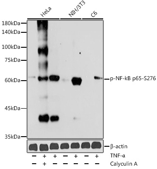 NFkB p65 (phospho Ser276)抗体 (GTX54672) | GeneTex中国官方网站