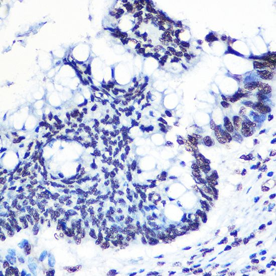 NFkB p65 (phospho Ser276)抗体 (GTX54672) | GeneTex中国官方网站