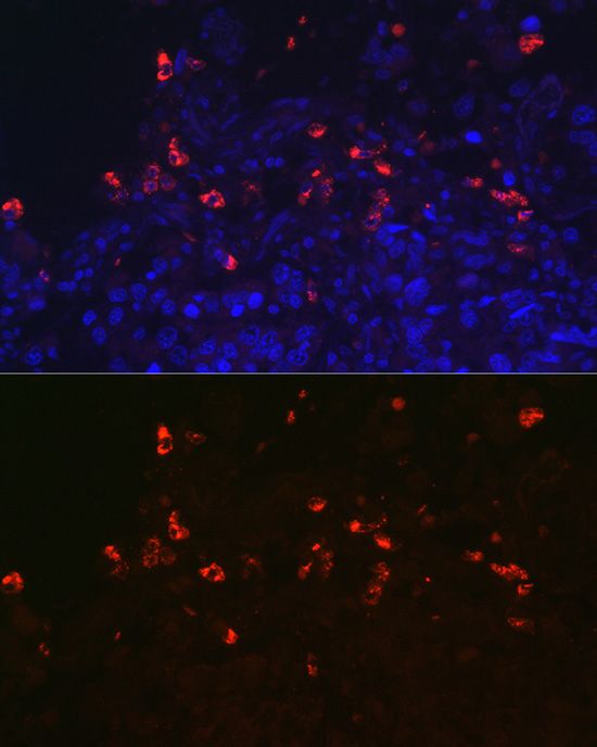 SFTPC抗体 (GTX54694) | GeneTex中国官方网站