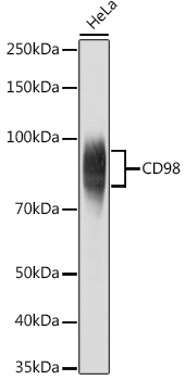 CD98抗体 (GTX54716) | GeneTex中国官方网站