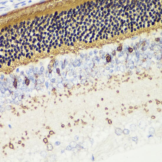 Recoverin抗体 (GTX54724) | GeneTex中国官方网站