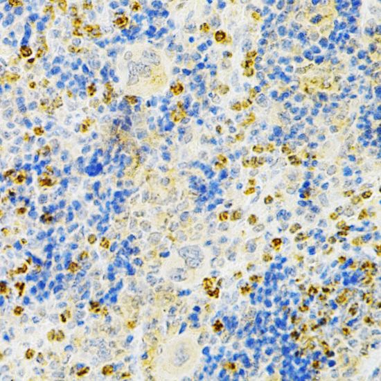 OPG抗体 (GTX55734) | GeneTex中国官方网站