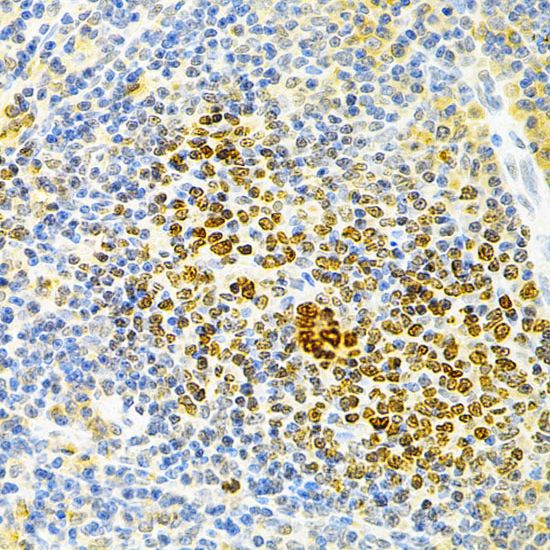 OPG抗体 (GTX55734) | GeneTex中国官方网站