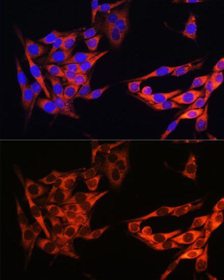 PI3 kinase p110 alpha抗体 (GTX55747) | GeneTex中国官方网站