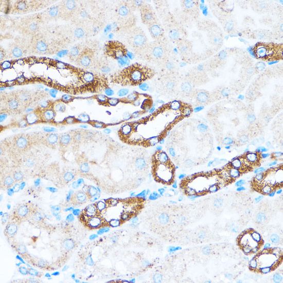 PI3 kinase p110 alpha抗体 (GTX55747) | GeneTex中国官方网站