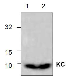 CXCL1 / GRO alpha抗体 (GTX59776) | GeneTex中国官方网站