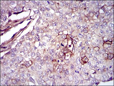 Fibronectin抗体 [2F4] (GTX60570) | GeneTex中国官方网站