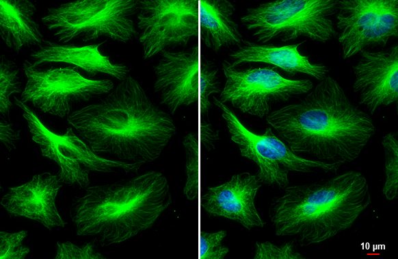 alpha Tubulin抗体 [GT114] (GTX628802) | GeneTex中国官方网站