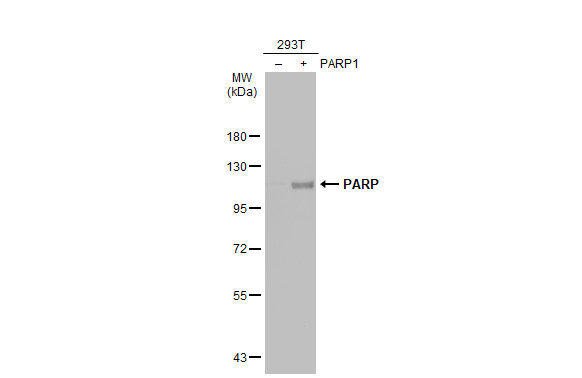 PARP抗体 [GT6212] (GTX628836) | GeneTex中国官方网站