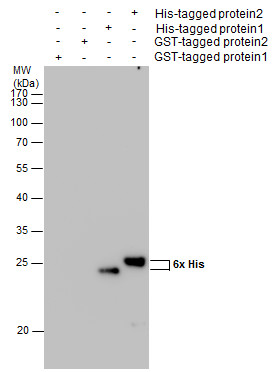 6X His tag抗体 [GT359] (HRP) (GTX628914-01) | GeneTex中国官方网站