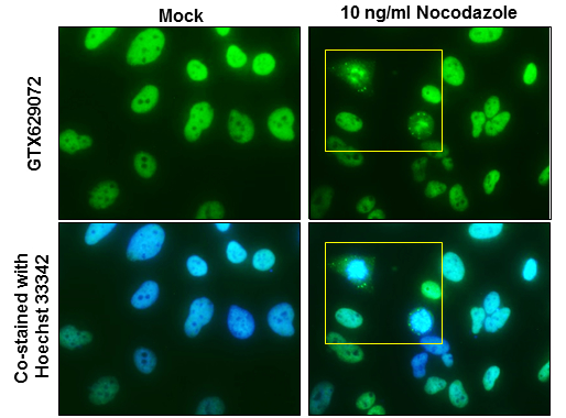 NuMA抗体 [GT1510] (GTX629072) | GeneTex中国官方网站
