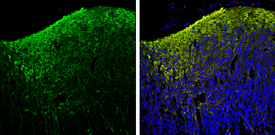beta Tubulin 3/ Tuj1抗体 [GT886] (GTX631830) | GeneTex中国官方网站