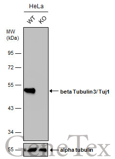 beta Tubulin 3/ Tuj1抗体 [GT1338] (GTX631831) | GeneTex中国官方网站