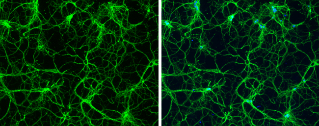 beta Tubulin 3/ Tuj1抗体 [GT11710] (GTX631836) | GeneTex中国官方网站