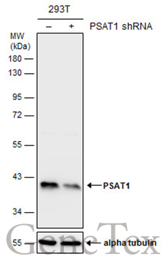 PSAT1抗体 [GT1353] (GTX633629) | GeneTex中国官方网站