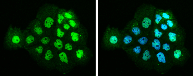 p63抗体 [GT1179] (GTX633818) | GeneTex中国官方网站