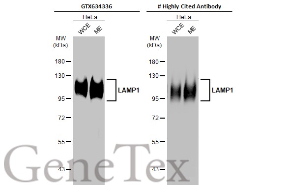 LAMP1抗体 [GT25212] (GTX634336) | GeneTex中国官方网站