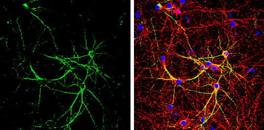 MAP2抗体 [GT925] (GTX634473) | GeneTex中国官方网站