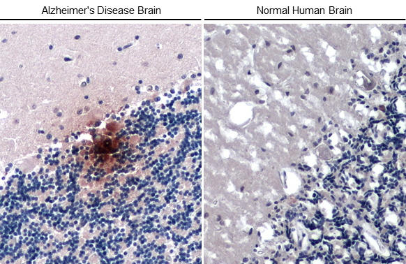Beta amyloid (1-42)抗体 – Conformation Specific抗体 [GT622] (GTX635160) | GeneTex中国官方网站
