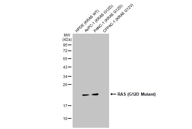 RAS (G12D Mutant)抗体 [HL10] (GTX635362) | GeneTex中国官方网站