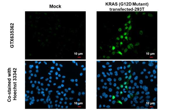 RAS (G12D Mutant)抗体 [HL10] (GTX635362) | GeneTex中国官方网站