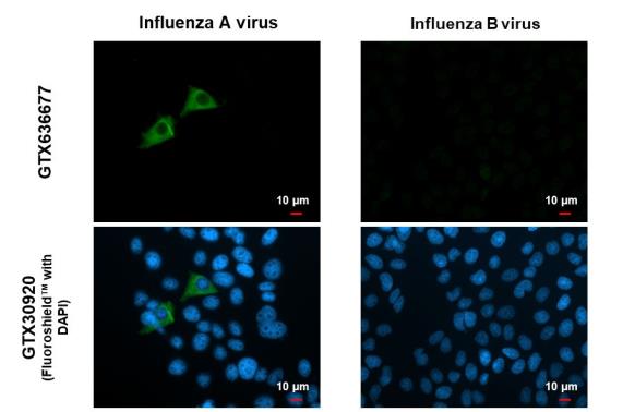 Influenza A virus M1 (matrix protein) antibody [HL1275] (GTX636677 ...