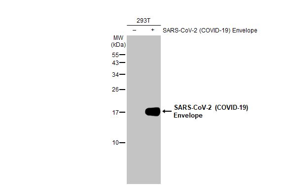 SARS-CoV-2 (COVID-19) Envelope antibody [HL1443] (GTX636915) | GeneTex ...