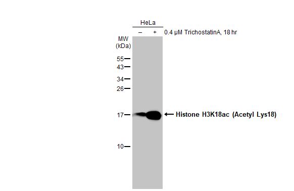 Histone H3K18ac (Acetyl Lys18) antibody [HL1463] (GTX636937) | GeneTex ...