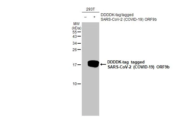SARS-CoV-2 (COVID-19) ORF9b antibody [HL1917] (GTX637666) | GeneTex中国官方网站