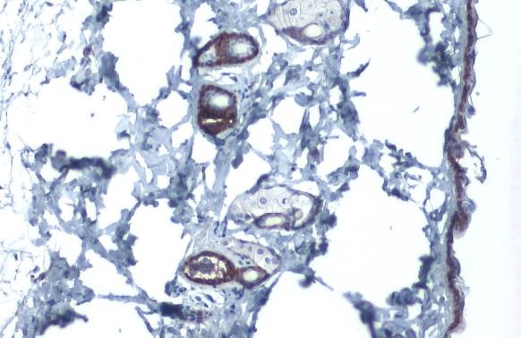 COL17A1抗体 [GT1055] (GTX64247) | GeneTex中国官方网站