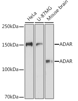 ADAR1抗体 (GTX64415) | GeneTex中国官方网站