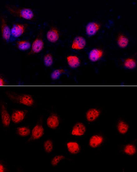 ADAR1抗体 (GTX64415) | GeneTex中国官方网站