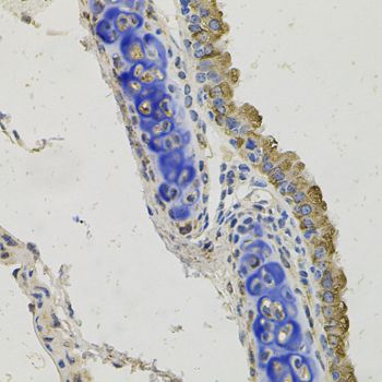 GAS6抗体 (GTX64470) | GeneTex中国官方网站