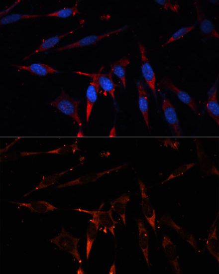 CPT1B抗体 (GTX64535) | GeneTex中国官方网站