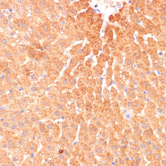 CPT1B抗体 (GTX64535) | GeneTex中国官方网站