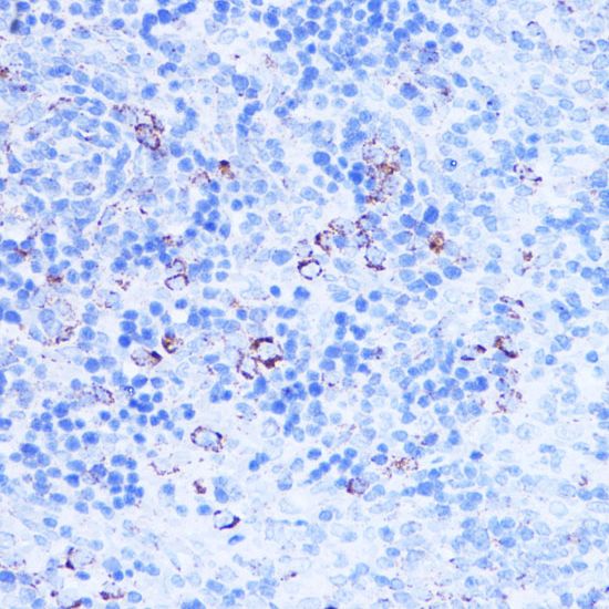 SHMT2抗体 (GTX64542) | GeneTex中国官方网站