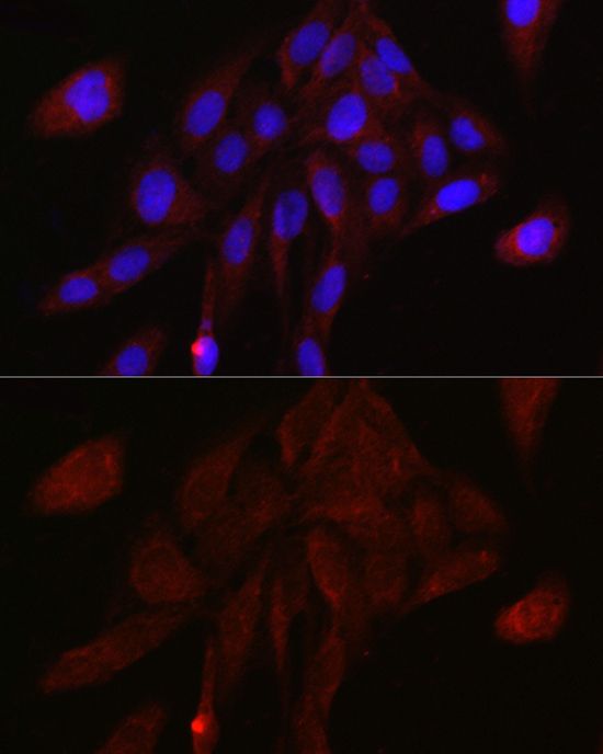 TMPRSS2抗体 (GTX64544) | GeneTex中国官方网站