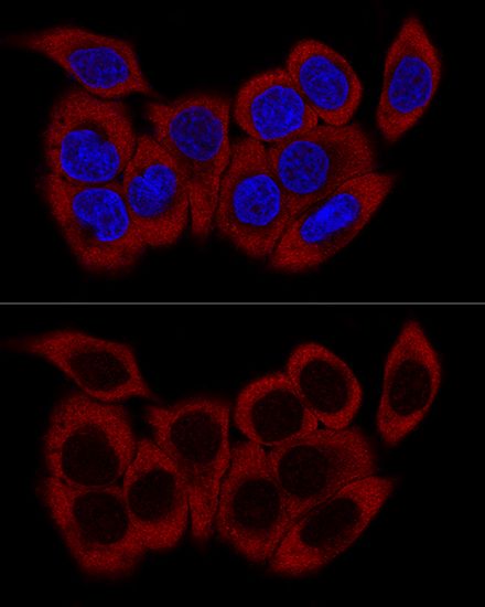RPL23抗体 (GTX64903) | GeneTex中国官方网站