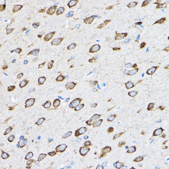 RPL23抗体 (GTX64903) | GeneTex中国官方网站