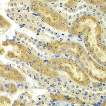 PAK2抗体 (GTX65807) | GeneTex中国官方网站