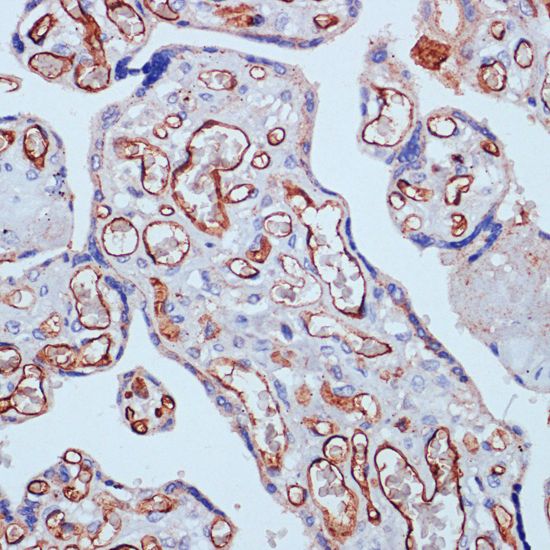 CD34抗体 (GTX65867) | GeneTex中国官方网站