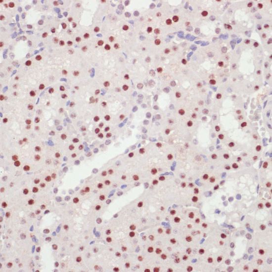 U1 snRNP70抗体 (GTX65948) | GeneTex中国官方网站