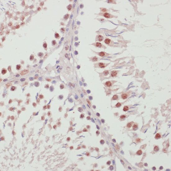 U1 snRNP70抗体 (GTX65948) | GeneTex中国官方网站