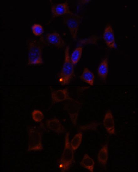YTHDC2抗体 (GTX66320) | GeneTex中国官方网站